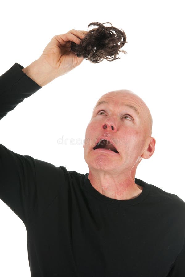 Nuevo Pelo Para El Hombre Calvo Imagen de archivo - Imagen de alegre ...