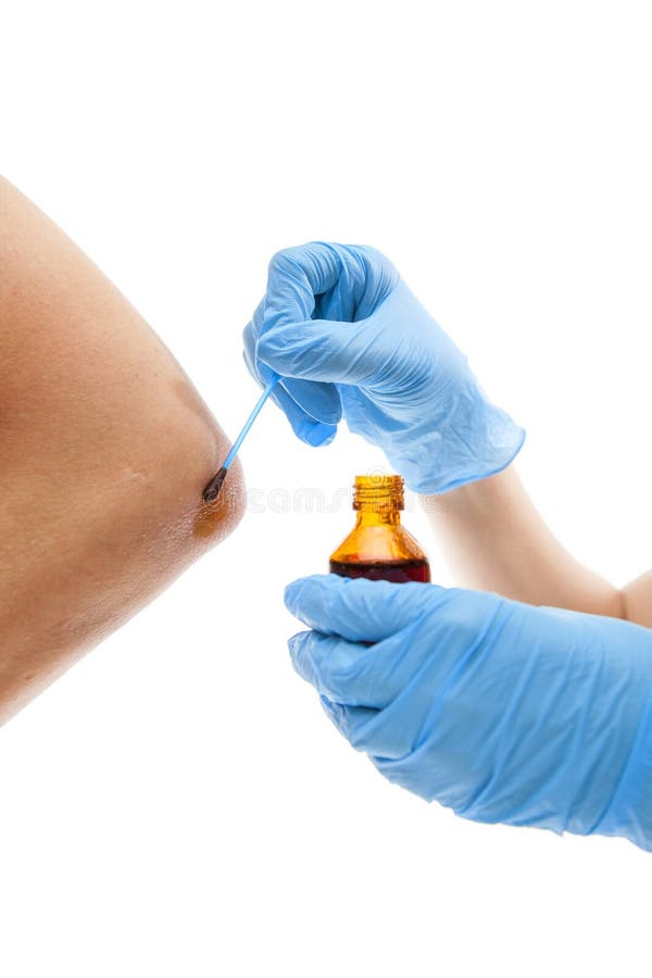 Nurse applying iodine stock photo. Image of analysis - 55990226