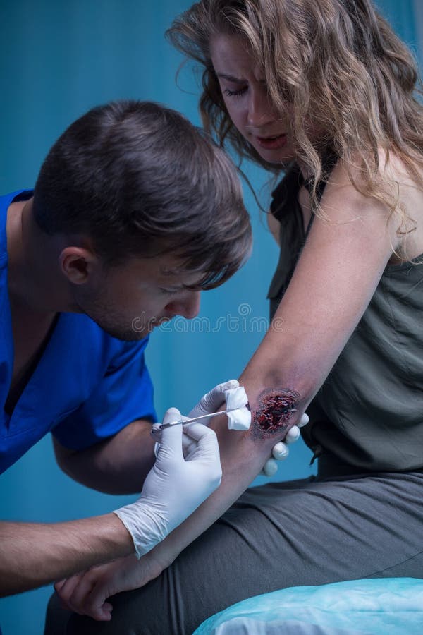 Nurse dressing elbow wound stock image. Image of doctor - 59144735