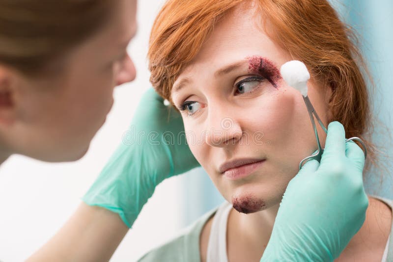 Nurse dressing the wound stock image. Image of close - 64678951