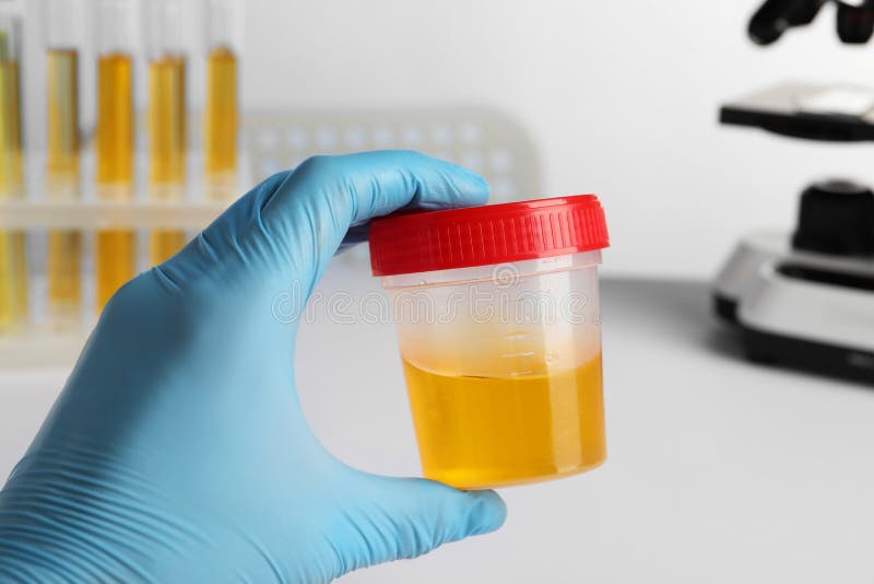 Nurse Holding Container with Urine Sample for Analysis in Laboratory ...