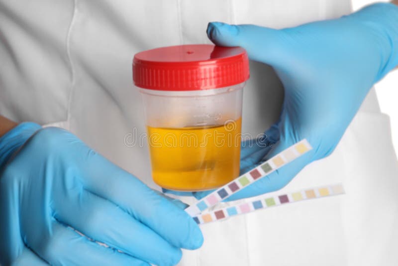 Nurse Holding Test Strips Container Urine Sample Analysis Closeup Stock ...