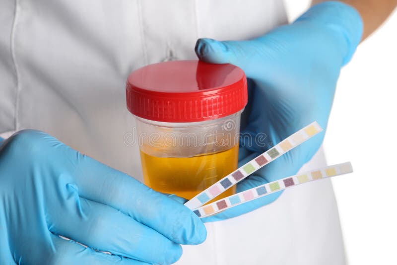 Nurse Holding Test Strips Container Urine Sample Analysis Closeup Stock ...