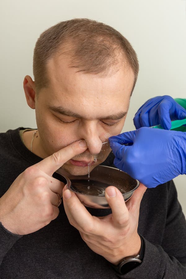 A Nurse Rinses the Nasal Cavity of a Patient Stock Image - Image of ...
