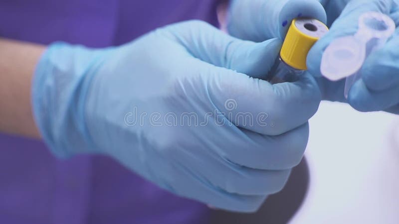 Nurse Scan Test Tube with Analysis and Put in a Support Under ...