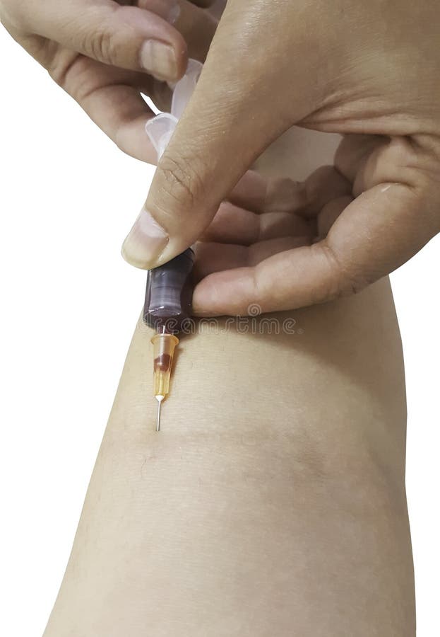 Nurse Taking Real Blood Samples Phlebotomist for Analysis from a ...