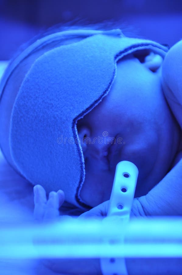 Nyfödd gulsot fotografering för bildbyråer. Bild av lampa - 23703015