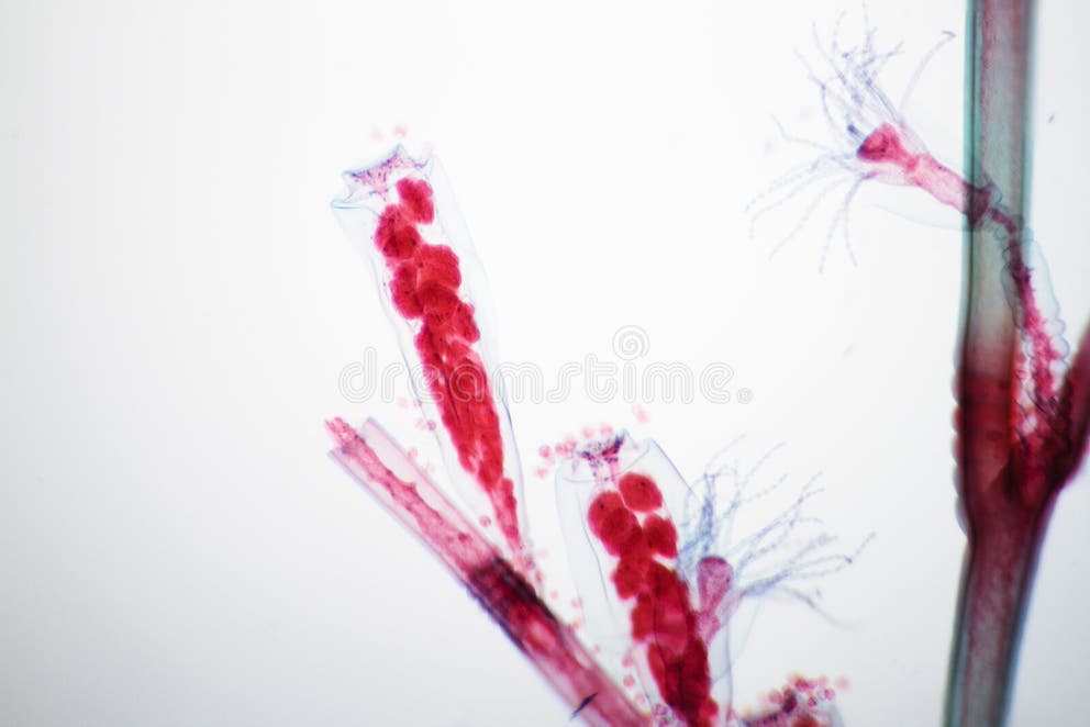 Obelia hydroid stock image. Image of microscope, hydrozoa - 119628405