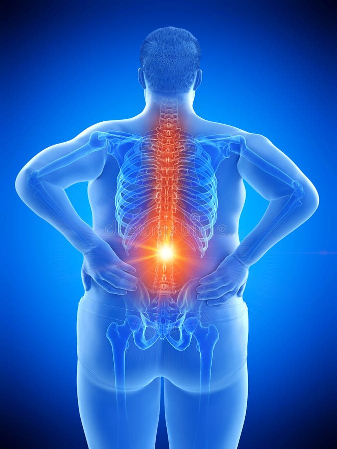 An obese mans painful back stock illustration. Illustration of ache ...