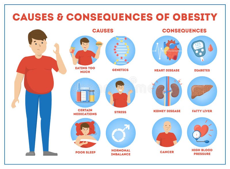 Obesity: Causes and Effects Stock Illustration - Illustration of ... Obesity: Causes and Effects Stock Illustration - Illustration of ...