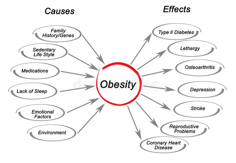 Obesity Causes and Prevention. Young Guy before and after Diet and ...