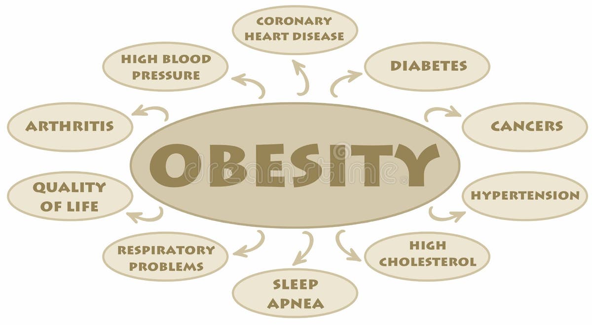 Obesity Diagram Stock Illustrations – 823 Obesity Diagram Stock ...