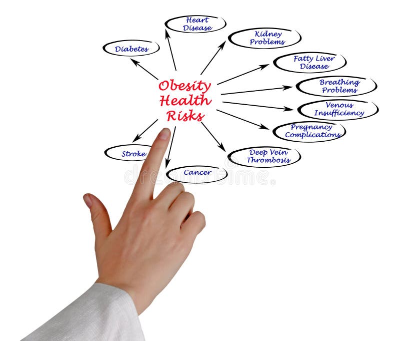 Obesity Health Risks stock image. Image of person, insufficiency - 85667431