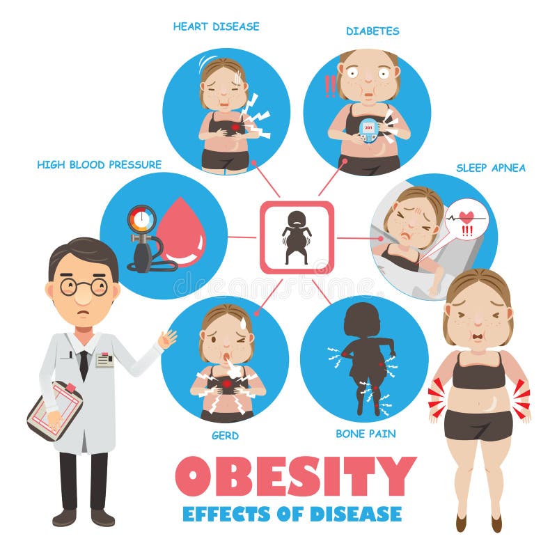 Vector Medical Poster Obesity. Stock Vector - Illustration of child ...
