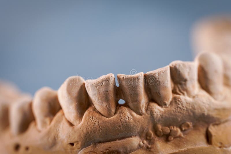 Object Image of a Dental Impression Stock Image - Image of prosthetic ...