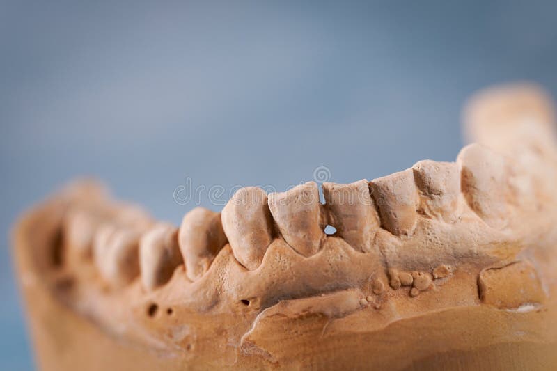 Object Image of a Dental Impression Stock Image - Image of artificial ...