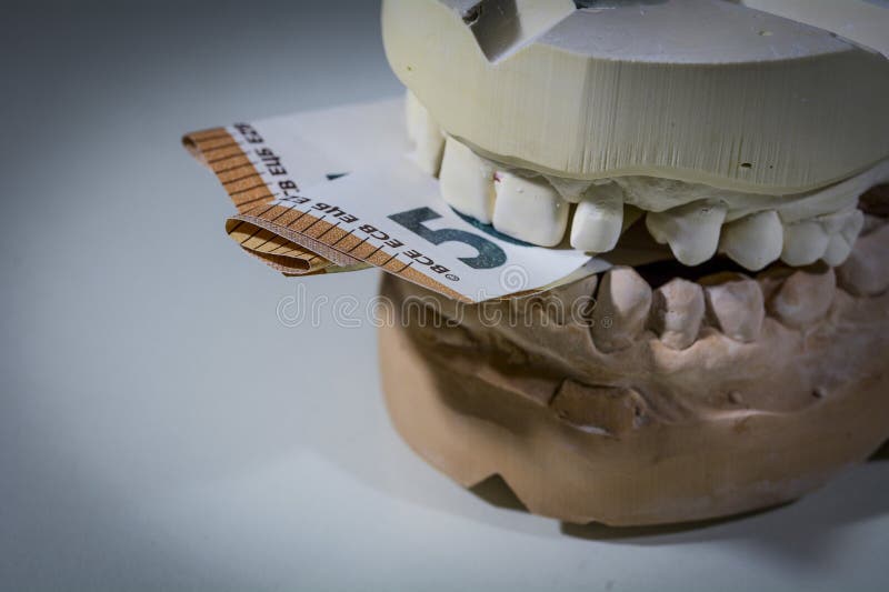 Object Image of a Medical Dental Impression Stock Photo - Image of ...