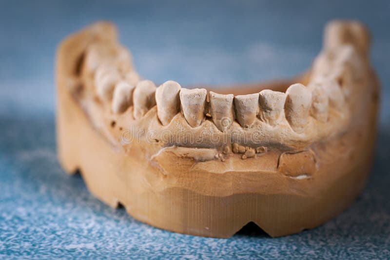 Object Image of a Dental Impression Stock Image - Image of medicine ...