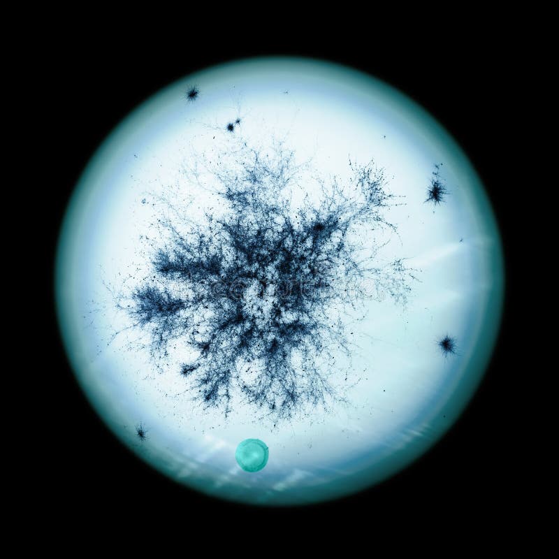 Microscope of Black Fungus Spore Strain with Lactophenol Cotton Blue ...