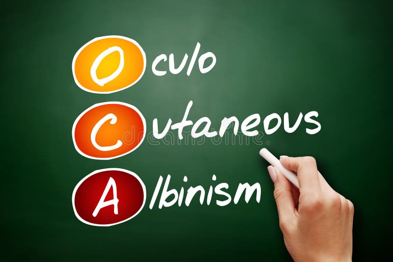 OCA - Oculo Cutaneous Albinism Acronym, Concept on Blackboard Stock ...