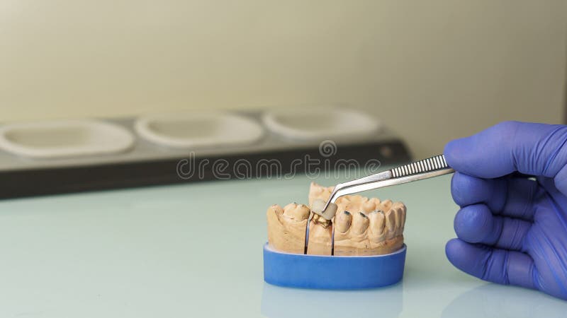 Odontolog?a dental foto de archivo. Imagen de oral, médico - 160261232