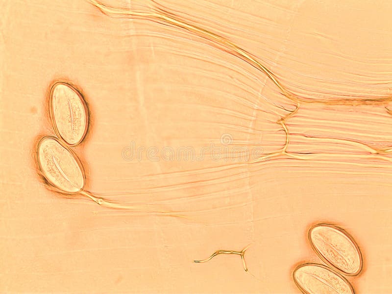 Oeufs D'oxyure (vermicularis D'Enterobius) Image stock - Image of oeufs ...