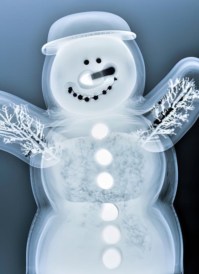 Snowman Radiography Stock Illustrations – 1 Snowman Radiography Stock ...