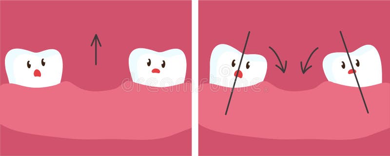 Offset Teeth Stock Illustrations – 19 Offset Teeth Stock Illustrations ...