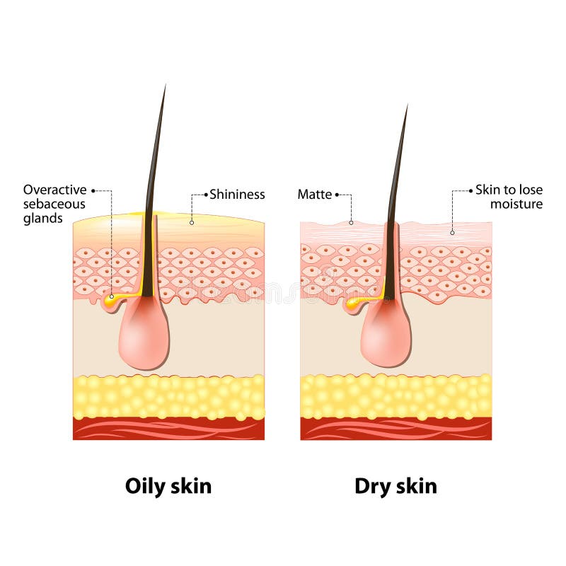 Oily & dry skin stock vector. Illustration of biology - 82898552