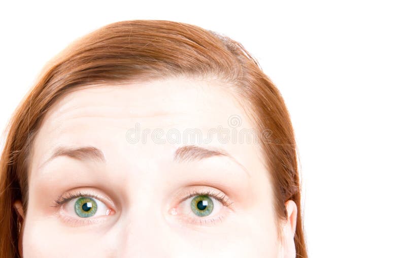 Ojo Humano Con Hemorragia Subconjuntival Visible. Sangre En El Ojo ...