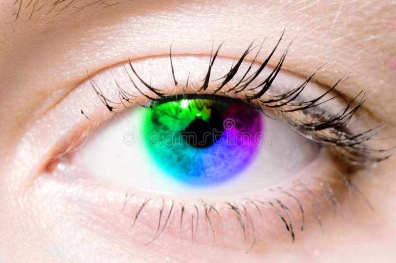 Ojo Humano Con Hemorragia Subconjuntival Visible. Sangre En El Ojo ...