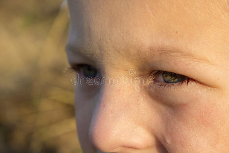 Ojos llorosos imagen de archivo. Imagen de dolor, persona - 51186901