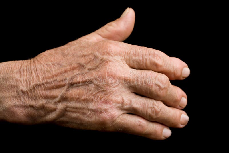 Old hand with arthritis stock photo. Image of worker, fingers - 8292326