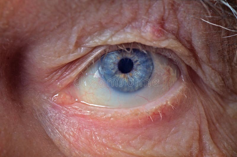 Close Up of Eye Senior Caucasian Man Stock Image - Image of opened ...