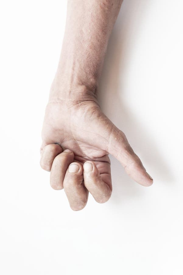 Old Man S Hand Spasms of the Muscles, Joints, and Fingers Stock Photo ...