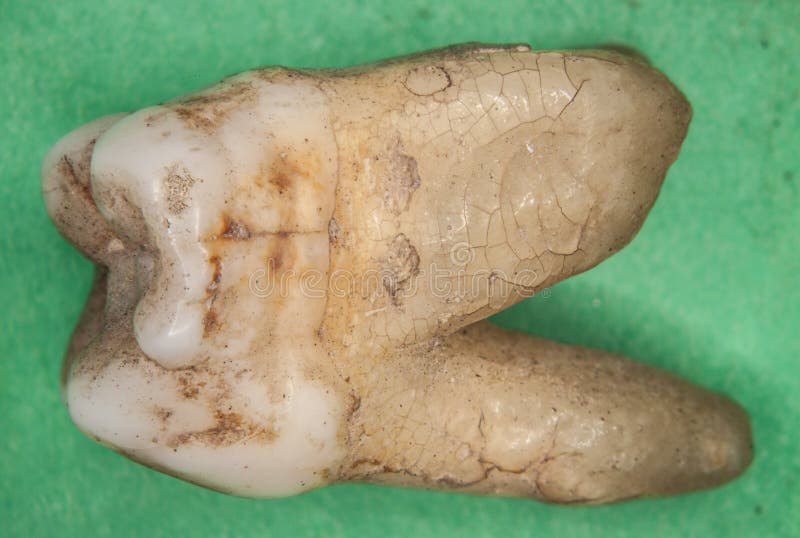 Old molars of humans stock image. Image of chewing, grind - 192981293