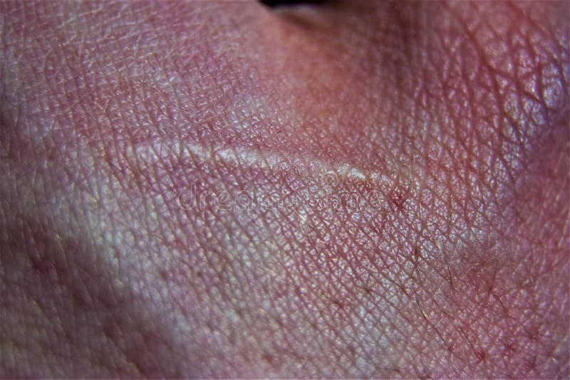 Large Scar And Scar On The Face Of A Beautiful Girl Near The Temple ...