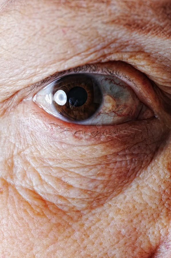 Old eye stock photo. Image of black, feebleness, thin, experiment - 528812