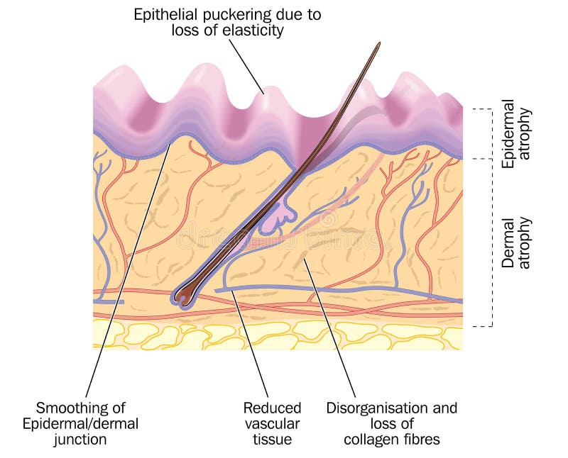 Skin epithelial tissue Free Stock Photos - StockFreeImages