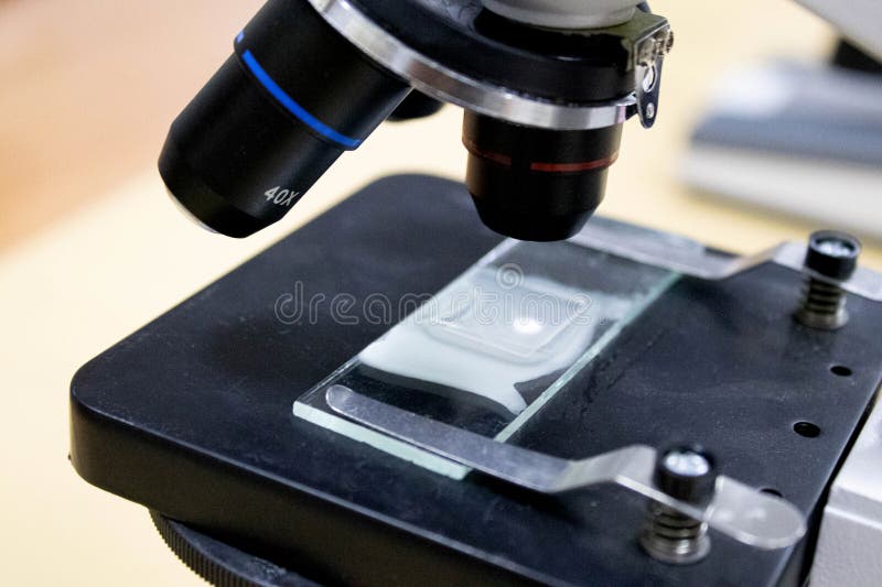 Black Microscope Slide with Red Blood Cells and White Blood Cells Stock ...