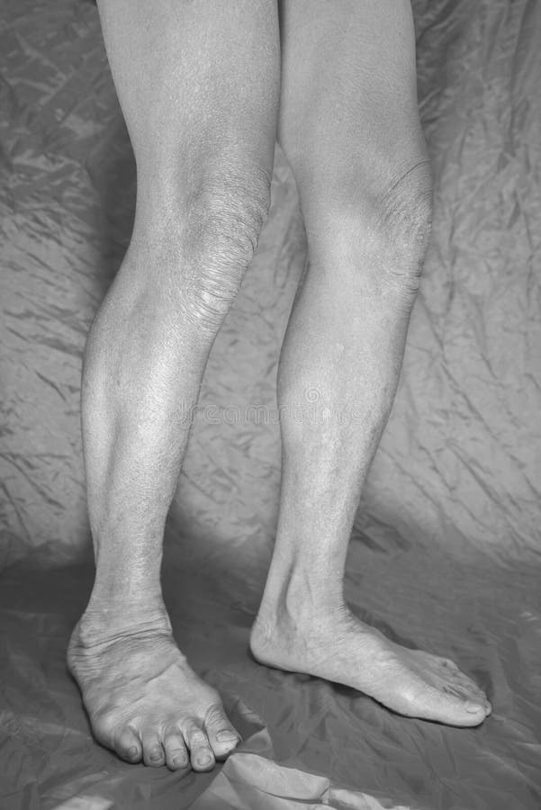 Older People& X27;s Foot and Leg Muscles Stock Image - Image of mycosis ...