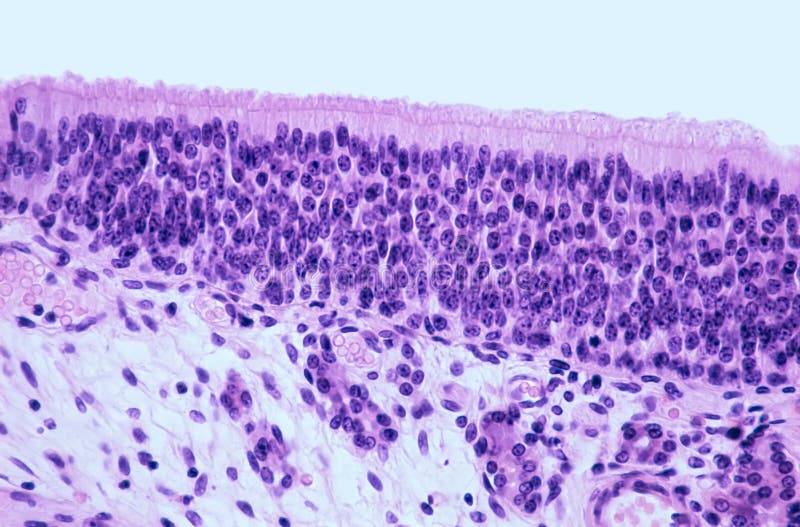 Bowman Glands Stock Photos - Free & Royalty-Free Stock Photos from ...