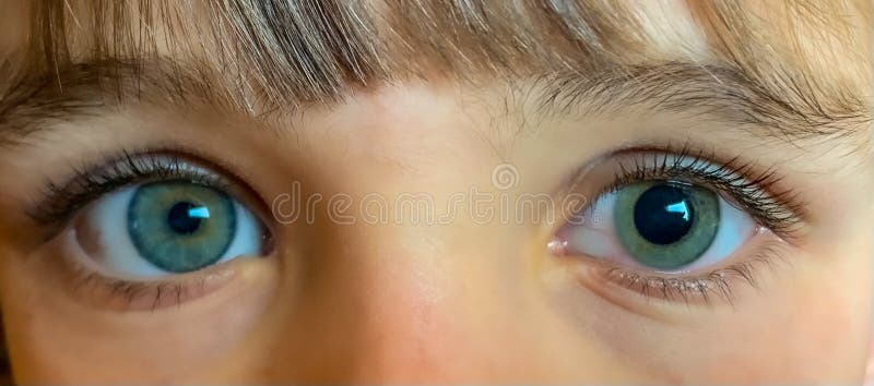 137 Dilated Pupil Stock Photos - Free & Royalty-Free Stock Photos from ...