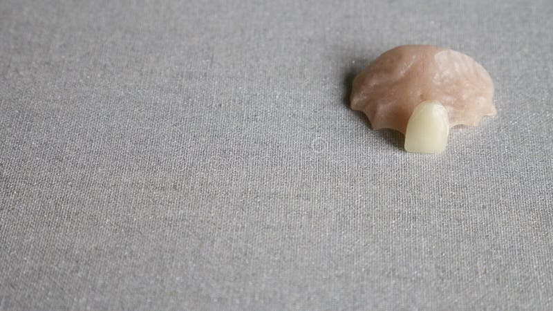 One False Plastic Tooth. Dental Prosthetics on a Background. Dentures ...