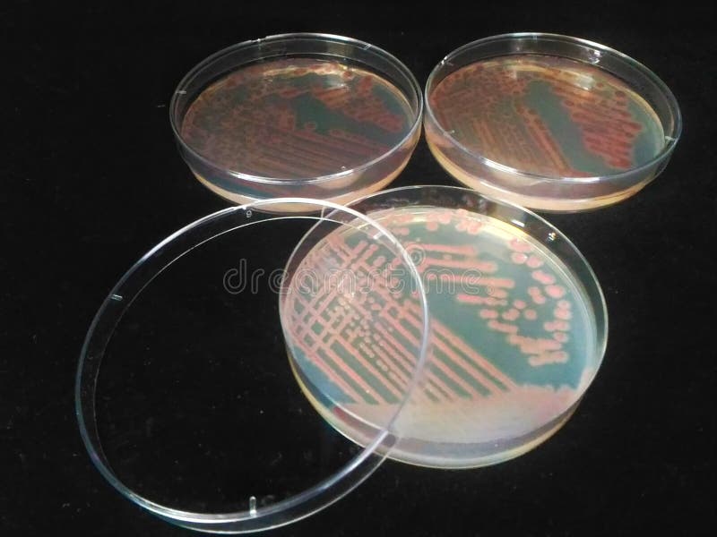Bacteria colony stock photo. Image of microorganisms - 102778110