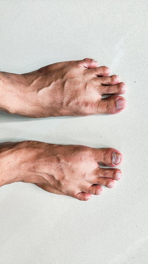 One Form of Worker& X27;s Foot Stock Photo - Image of muscle, limb ...