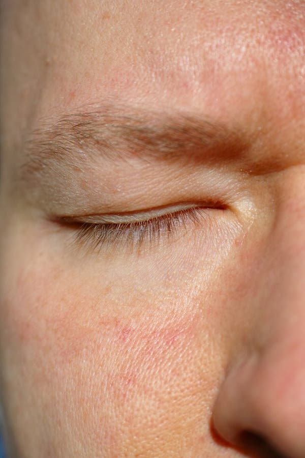 Eyelid with Blood Vessels Veins Stock Image - Image of white, closeup ...