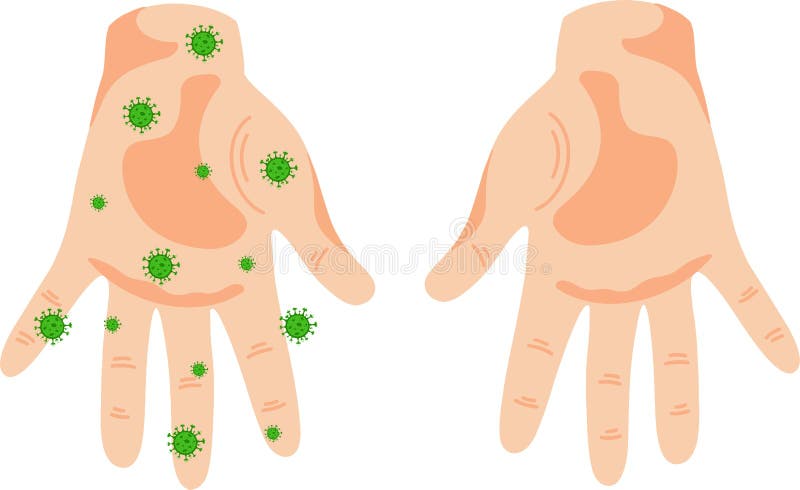 One Hand is Clean,the Other Hand Has Germs and Viruses. Stock Vector ...