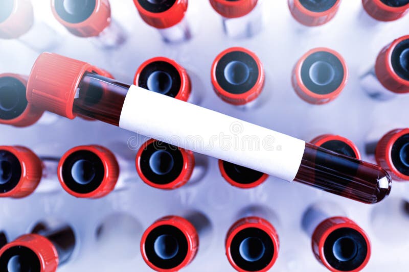 One Sample Tube with Blood and Blank Label on Others, Closeup ...