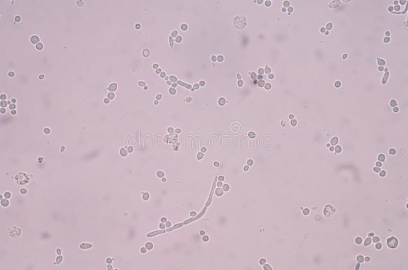 Ontluikende Gistcellen Met Pseudohyphae in Urinesteekproef Stock Foto ...